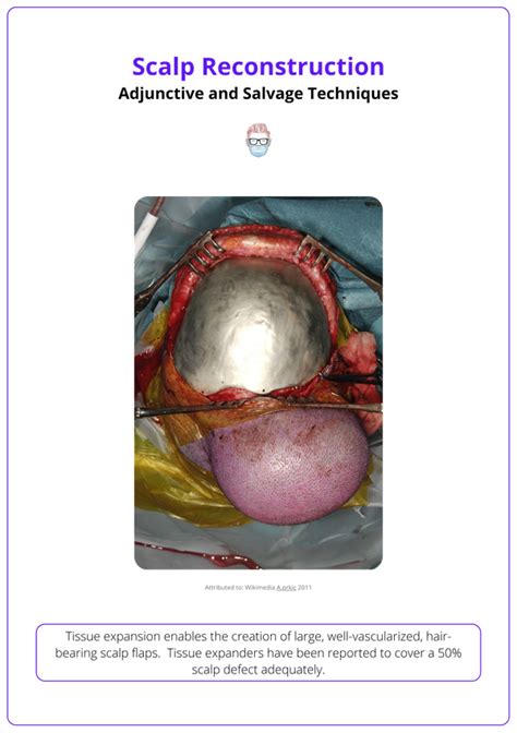 Scalp Reconstruction Anatomy Surgical Technique And Reconstructive Options
