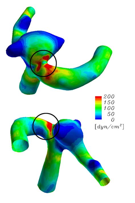 WSS Distribution For Model 2 Download Scientific Diagram