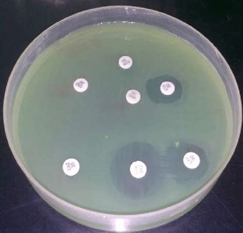 Extended­spectrum­â­lactamaseesbl Producing Paeruginosa Detection By Download Scientific