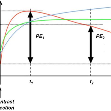 Kinetics Of Contrast Enhancement On Breast Mri Captured On A Signal Download Scientific Diagram