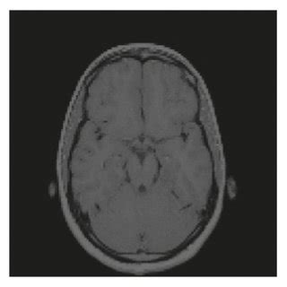 Discrete Fourier Transform Of The Medical Image A Original Medical Download Scientific