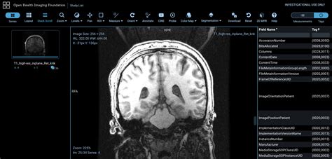 View And Annotate Images Flywheel Documentation