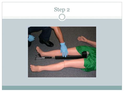 Ppt Sager Traction Splint Powerpoint Presentation Free Download Id 2998062