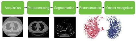 Five Steps Of Airway Reconstruction 3d Airway Reconstruction Involves Download Scientific