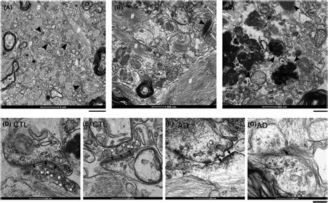 The Ultrastructure Of The Olfactory Glomerulus The Ultrastructure Of Download Scientific