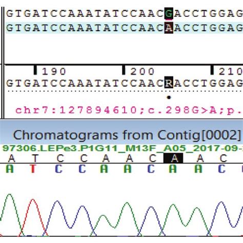 Sequence Chromatogram Showing Homozygous Missense Mutation In Exon 3 Of Download Scientific