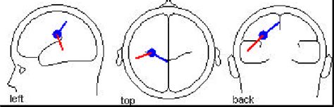 Standard Graphical Output Of Besa Software For Source Location Download Scientific Diagram