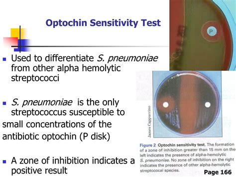 Ppt Streptococcus Powerpoint Presentation Free Download Id 2742719