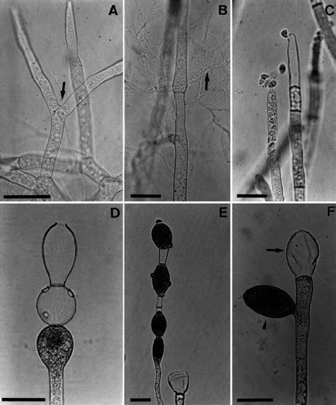 Morphological Characteristics Of Allomyces Arbuscula Njm 0212 A Download Scientific Diagram