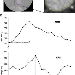 Illustration Of The Processing Steps Required To Calculate The Vessel Download Scientific