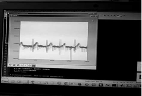 Figure From Biosignal Monitoring Platform Using Wearable IoT Semantic Scholar