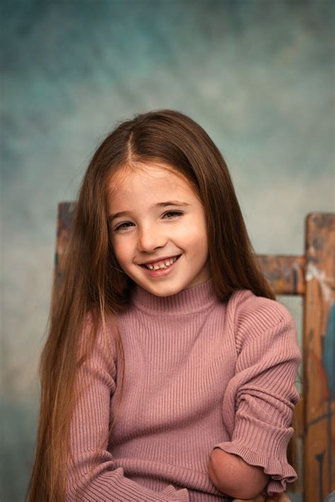 Ruby E Zebedee Talent Models With Disabilities Visible Differences