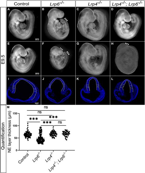Balancing WNT Signalling In Early Forebrain Development The Role Of