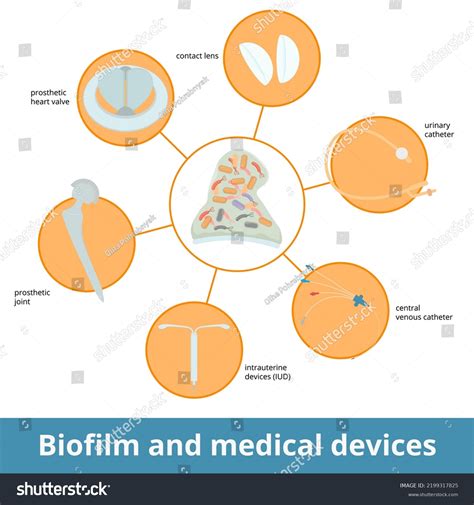 Biofilm Medical Devices Common Sources Biofilm Stock Vector Royalty Free 2199317825 Shutterstock
