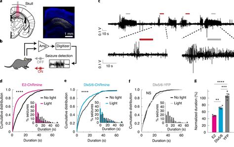 Closed Loop Optogenetics Soltesz Lab