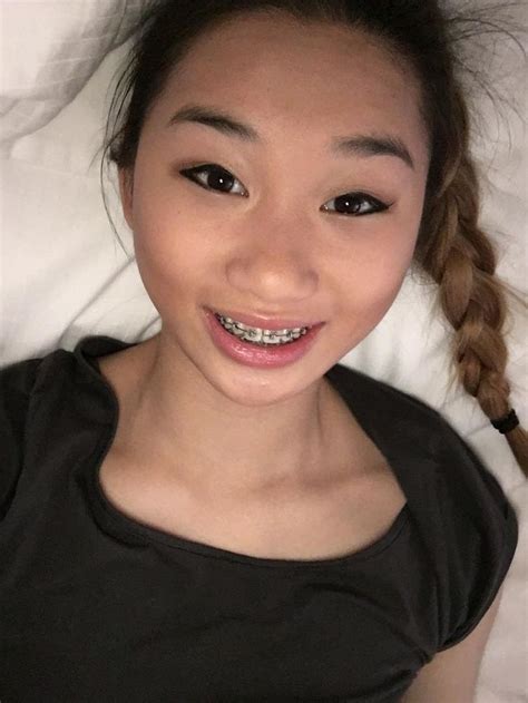 Pin By Lovewithbraces On Braces Braces Ponytail