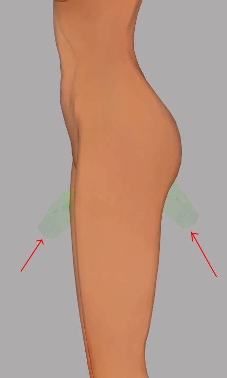 Furotrap Improved Tentacles V6 91 Last Updated Apr 20 Page 16 Downloads Oblivion