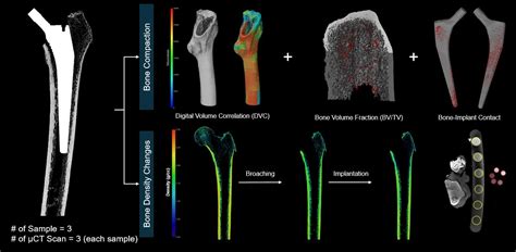 Imaging Techniques Show Inside Bones During Hip Replacement