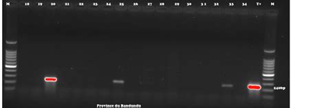 Occurrence And Distribution Of Banana Bunchy Top Virus Related Agro Ecosystem In South Western