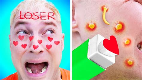 School Hacks To Hide Your Pimples Funny Gadgets Tips And Ideas To