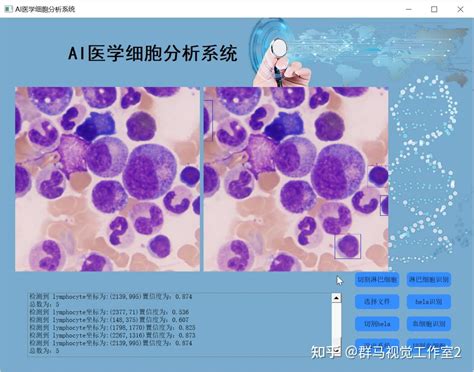 Python基于yolov7的显微镜下细胞识别＆分割系统源码＆部署教程＆数据集 知乎