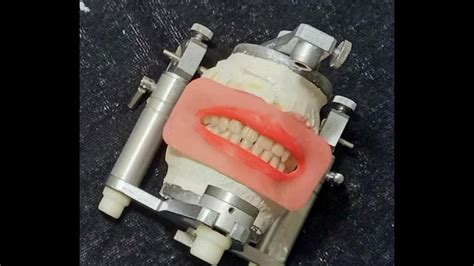 ساخت دندان مصنوعی طبیعی Youtube