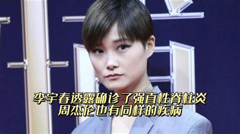 李宇春透露确诊了强直性脊柱炎周杰伦也有同样的疾病曾需要刘畊宏帮助才能翻身 高清1080P在线观看平台 腾讯视频