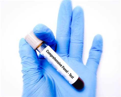 10 Cmp Blood Test Royalty Free Photos And Stock Images Shutterstock