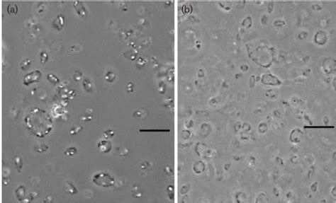 Halophiles Archaebacteria