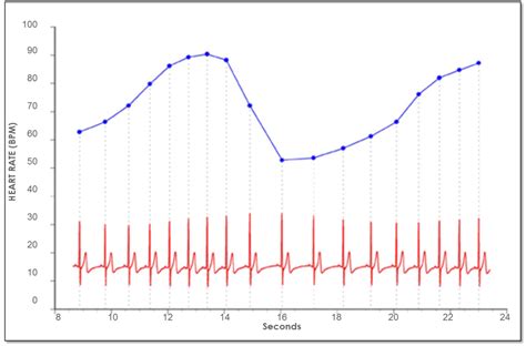 Heart Rate Variability Overview Heartmath Help