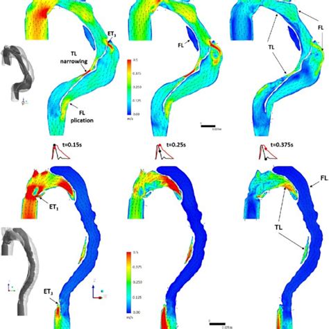 Velocity Vectors Superimposed On Velocity Iso Contours At T 0 In Planes Download Scientific