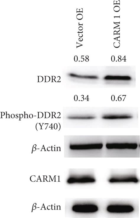Overexpression Of Carm1 Led To Senescence Resistance Through Ddr2 A