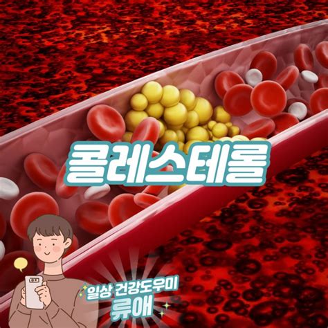 좋은 나쁜 콜레스테롤 높은 이유와 정상 콜레스테롤 수치 콜레스테롤약 효능 부작용 네이버 블로그