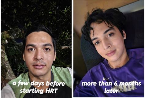 Ive Been On Hormones For More Than 6 Months And I Dont Know If Its