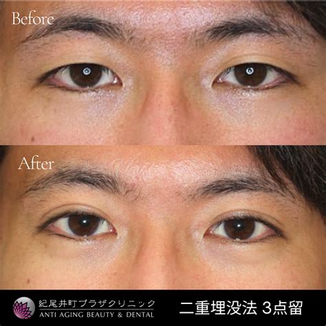 二重形成で後悔しないための注意点・対策とは？