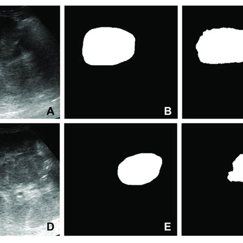 Samples Extracted From The Image Segmentation Dataset A D B Mode Download Scientific Diagram
