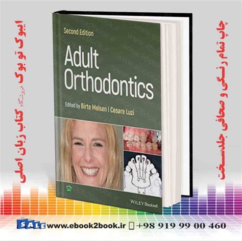 adult orthodontics 2nd edition فروشگاه کتاب ایبوک تو بوک