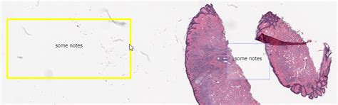 Four Ways To Add Annotations To PMA Core Using Python Real Data Digital Pathology Blog