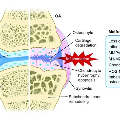Pathogenesis Of Oa And The Potential Metformin Targets Note ↑ Means
