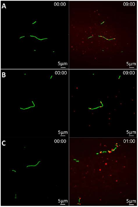 Tirf Microscopy Images Showing Gelsolin Binding And Or Severing