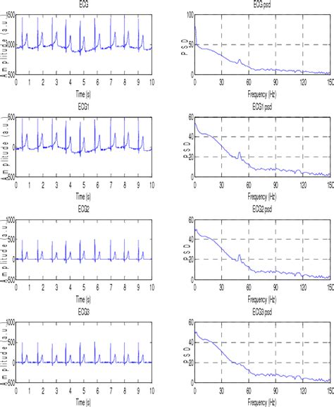 Figure 1 From Comparison Of Different Electrocardiogram Signal Power Line Denoising Methods