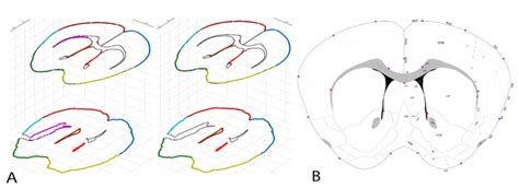 A Correspondences Used During Feature Based Non Linear Registration