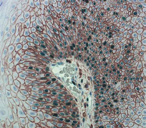 What Are The Differences Between Ihc And Ish And How Do They Help In