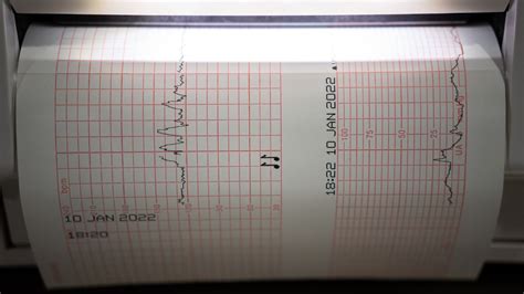 Graph Recorder Stata At Mae Kimbrell Blog