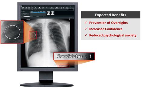 Highlight Introduction To Cxr Finding I An Ai Powered Chest X Ray Diagnostic Support System