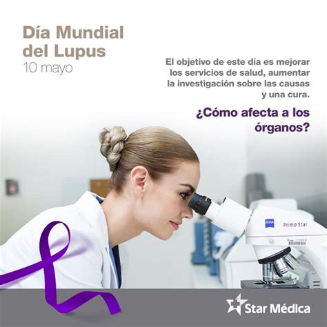 Star Médica El Lupus Es Una Enfermedad Multifactorial Y Facebook