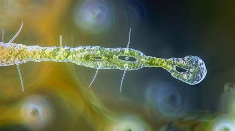 A Microorganism With A Single Long Flagellum Protruding From Its Body