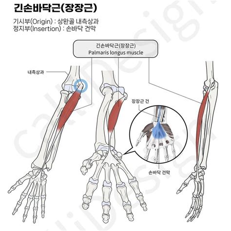 의학그림 메디컬 일러스트 Callidesign On Instagram 함께근육공부 시즌2 근육별기시정지 긴손바닥근장장근