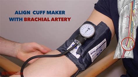 Blood Pressure Cuff Position At Brooke Fitzroy Blog