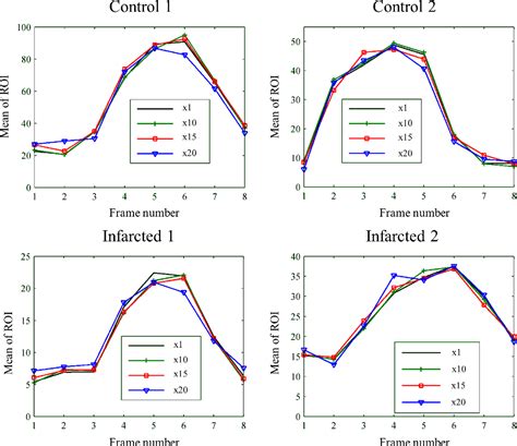 Figure 9 From Comparison Of Total Variation With A Motion Estimation